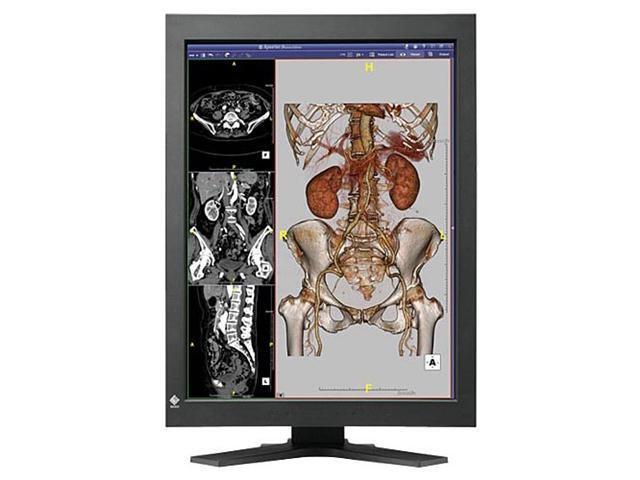 Eizo RadiForce RX220-BK 21.3' LCD Monitor - 17 ms - Newegg.com