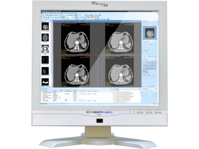 Cybernet CyberMed All-in-One Computer - Intel Pentium E5500 2.80 GHz ...