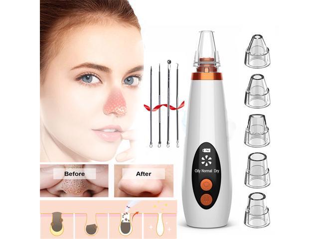 3 Speeds Electric Blackhead Remover Face Deep Pore Acne Skin Care ...
