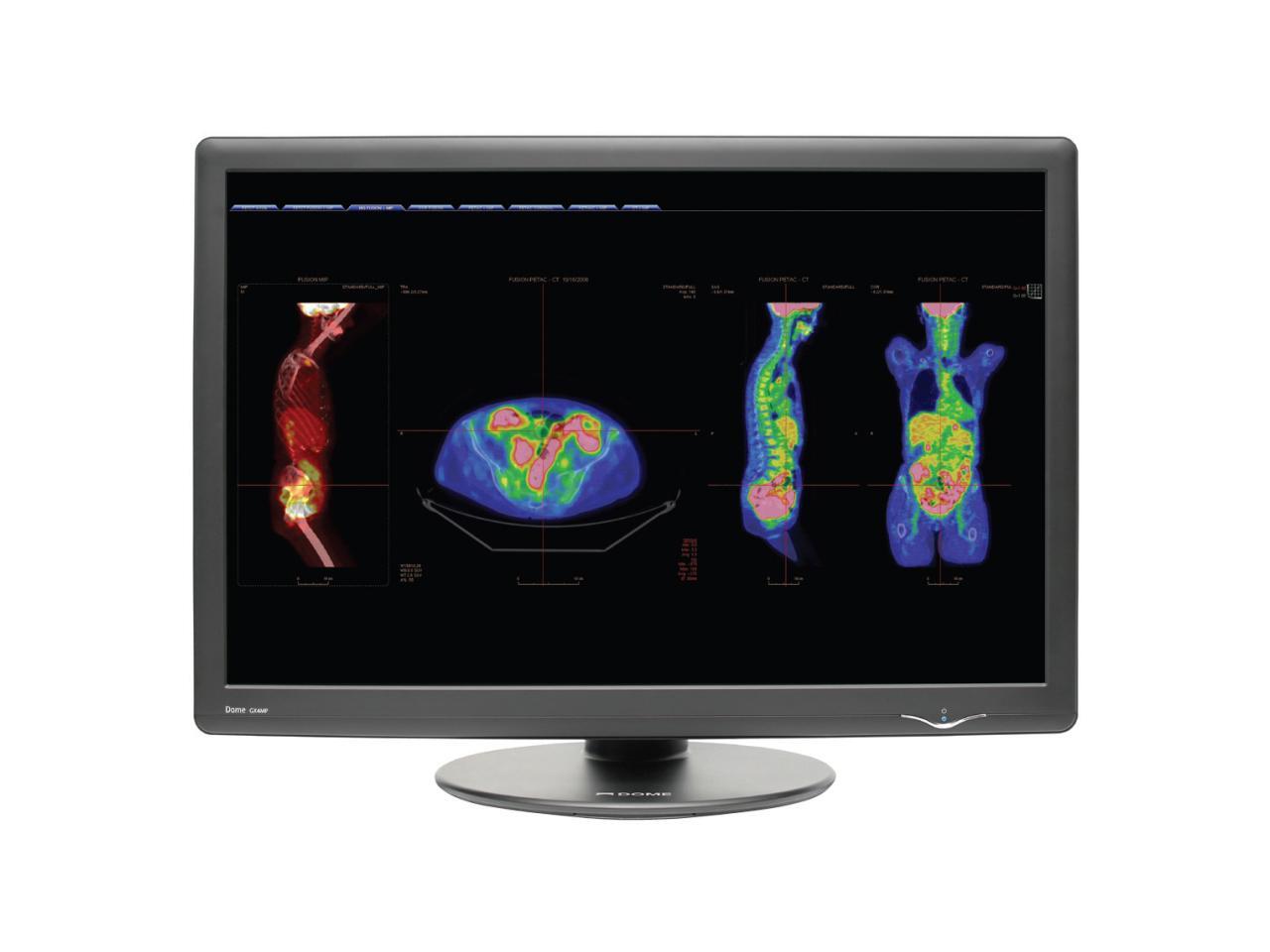 NDS Surgical Imaging Dome GX4MP 30" LCD Monitor - 12 ms - Newegg.com