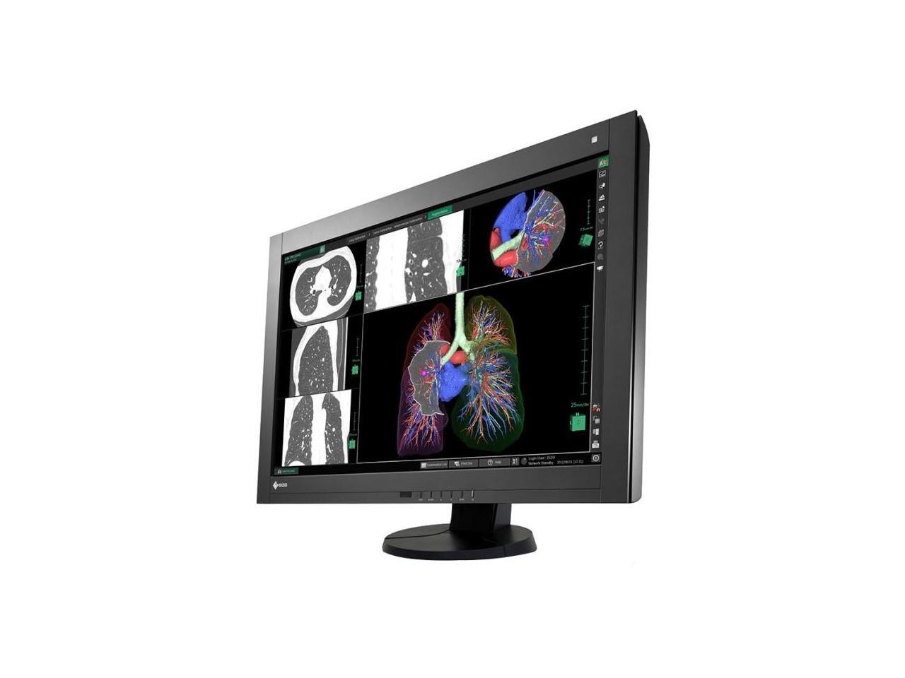 Eizo RadiForce RX440 29.8" LED LCD Monitor - 16:10 - 20 ms - Newegg.com