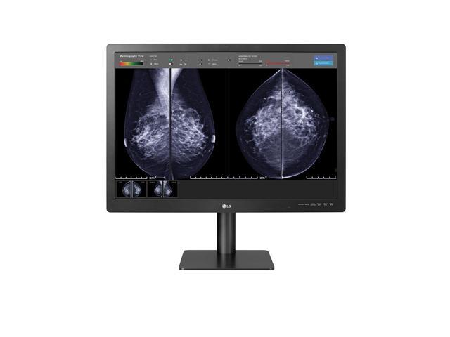 Click here for LG 31in MEDICAL ANTI-GLARE  3H DIGNOSTIC MONITOR 4... prices