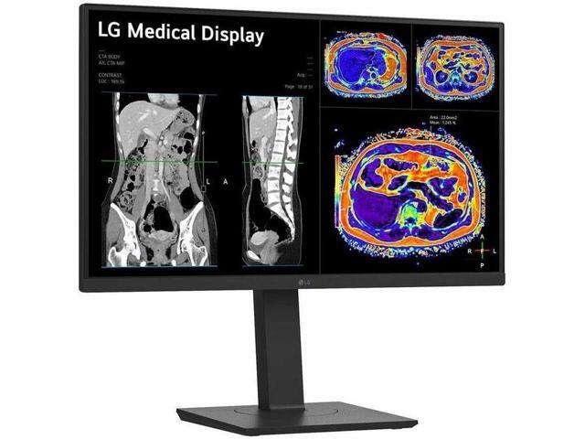 Click here for LG 27HS713C-B 27 Class Webcam 4K UHD LED Monitor -... prices