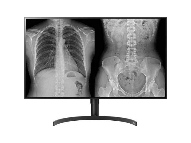 Click here for LG 32HL512D-B 31.5 3840x2160 4K LCD IPS 5ms HDMI D... prices