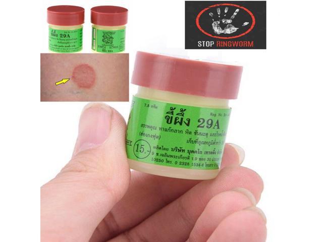 Click here for Ringworm Treatment - Herbal & Natural Ointment- Re... prices