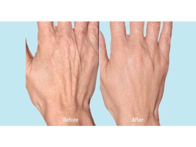 Click here for Ageless Hands Intensive Therapy by Biologic Soluti... prices