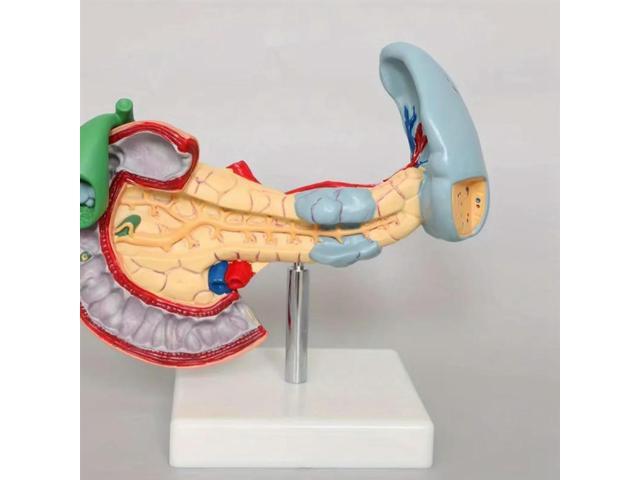 Click here for Duodenum And Spleen Pathology Model Pathological P... prices