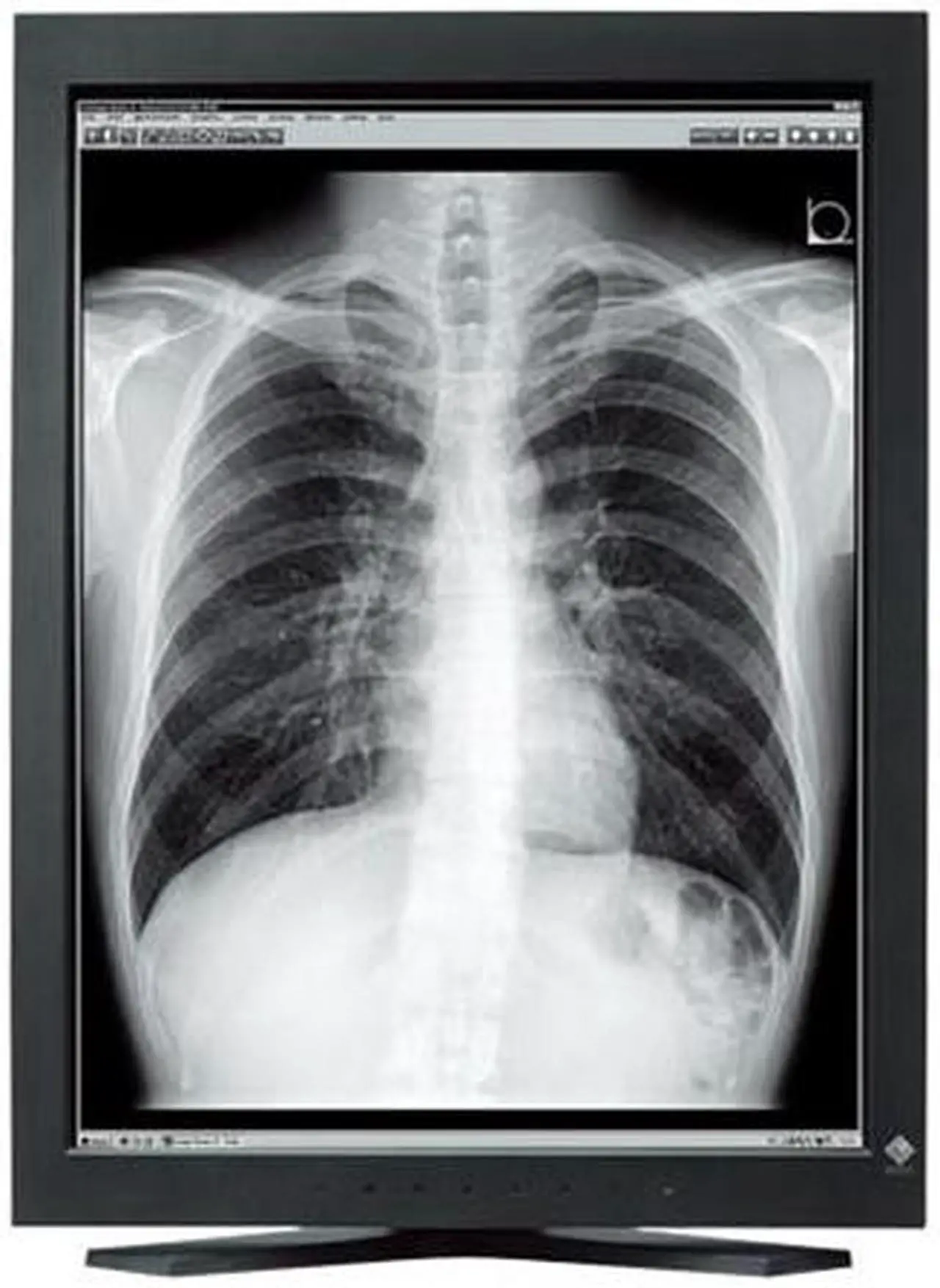 Eizo RadiForce GS320-CL 21.3' LCD Monitor - 23 ms - Newegg.com