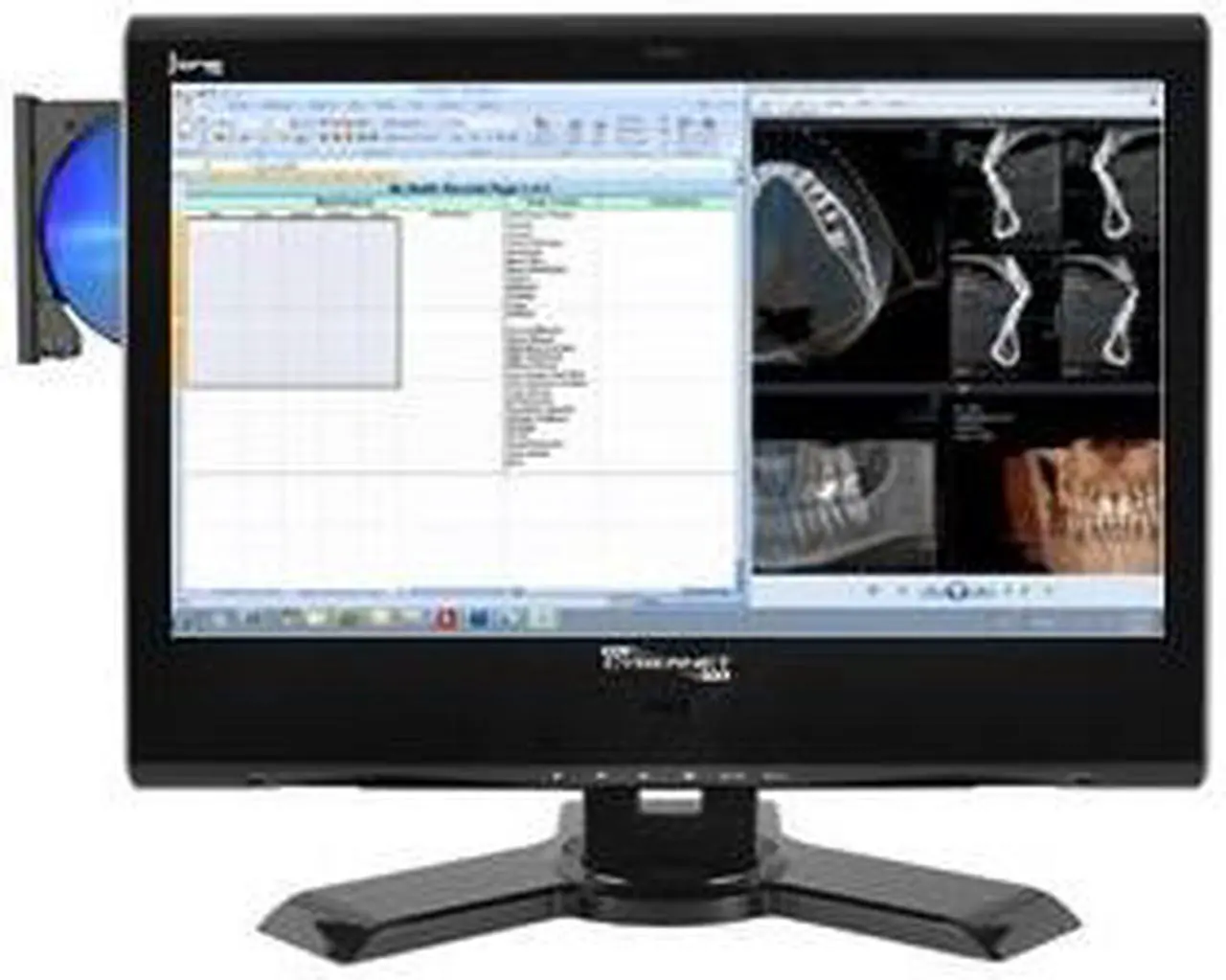 Cybernet iOne iOne-H5 All-in-One Computer - Intel Core i3 i3-550 3.20 ...