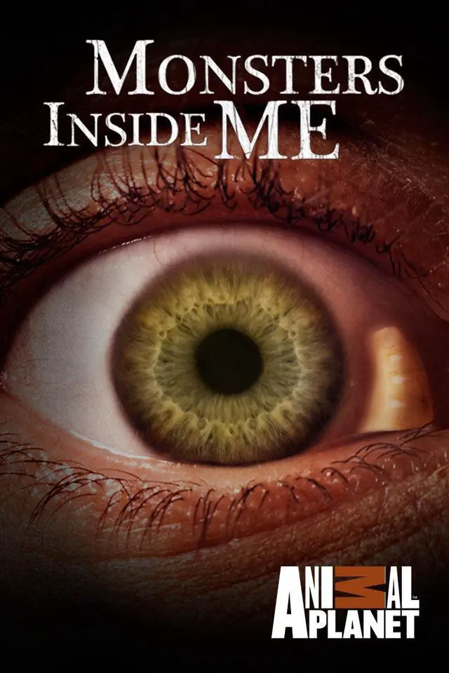 Monsters Inside Me: Season 6 Episode 5 - Worms Are Eating My Lungs [HD ...