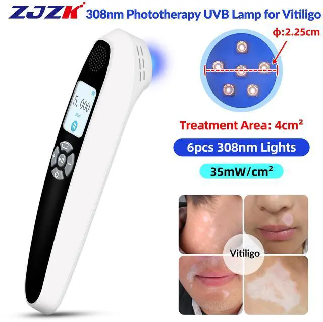 ZJZK Excimer Laser 308nm UVB Light Therapy Device Phototherapy At Home For Psoriasis Vitiligo ...